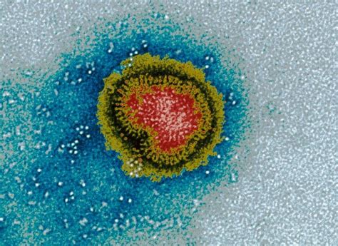 Grippe aviaire symptômes traitement prévention Institut Pasteur