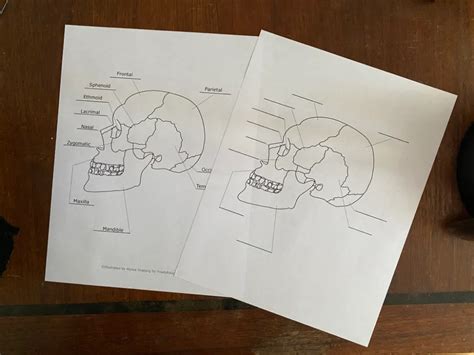 Two Diagrams Of The Human Skull On Top Of A Wooden Table Next To A