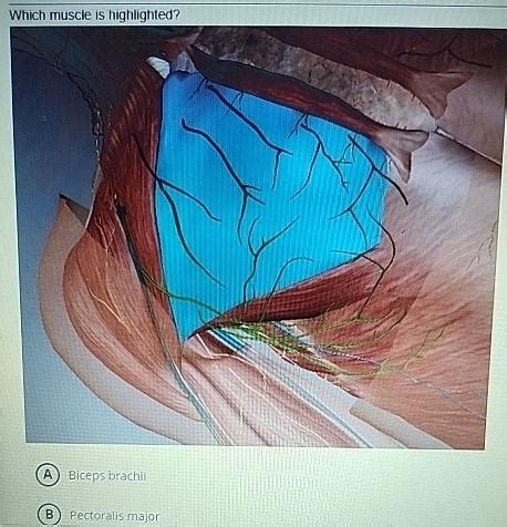 Solved Which Muscle Is Highlighted Biceps BrachiiPectoralis Chegg