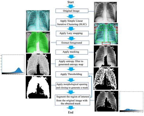 a novel method for automated lung region segmentation in chest x ray images
