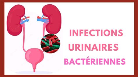 Les Infections Urinaires Bactériennes YouTube