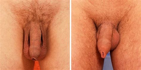 Penis Galerie Schau Welche Unterschiede Es Gibt Penis Galerie