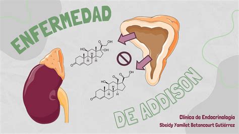 Enfermedad De Addison MARISOL GIL CHAVEZ UDocz