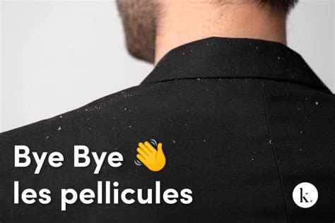 Pellicules les reconnaître et les traiter Conseils Beauté