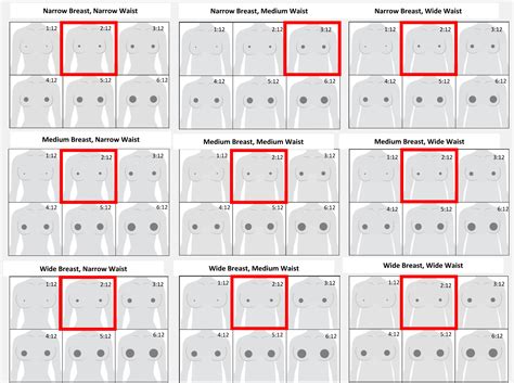 Nesps Perceptions Of Ideal Breast And Areola Dimensions A Global Survey Of 2259 Respondents