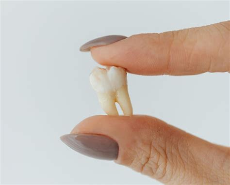 Extracciones Dentales Seguras Y Sin Dolor Dental Glow