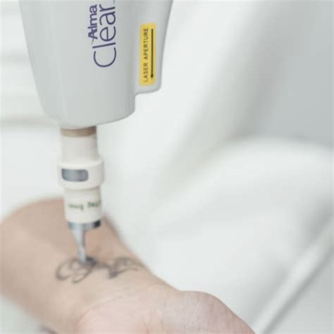 Our Treatments Mediface Aesthetics Doncaster Skin Treatments