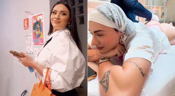 Cenapop Juju Salimeni impressiona ao mostrar bumbum após procedimento