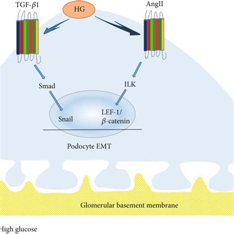 Podocyte detachment In elevated glucose levels TGF β provoked p38