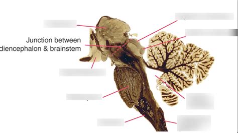 Brainstem Diagram Quizlet