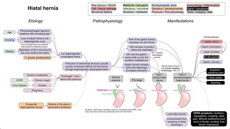 Hiatal Hernia Mechanism Of Disease YouTube