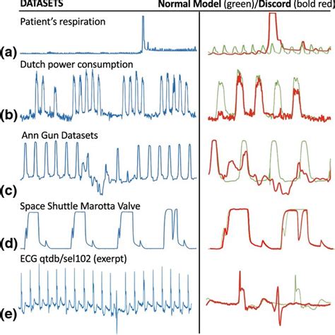 unsupervised and scalable subsequence anomaly detection in large data series request pdf