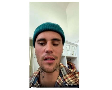 Quest Ce Que Le Syndrome De Ramsay Hunt Dont Souffre Justin Bieber