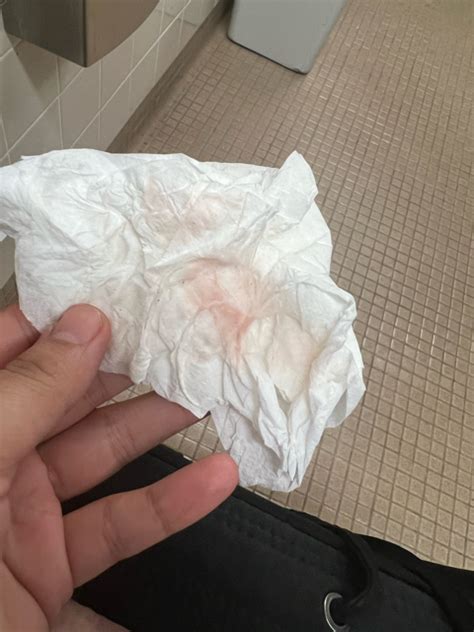 Is This Implantation Bleeding Glow Community