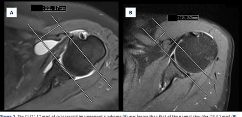 Figure 2 From Identification Of Diagnostic Magnetic Resonance Imaging
