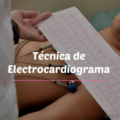 TÉCNICA DE ELECTROCARDIOGRAMA ECG EKG