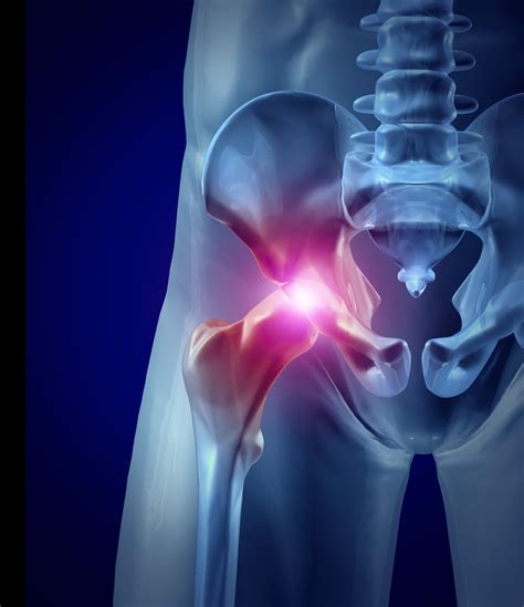 Pubalgia Causas Síntomas Y Tratamiento Mejor Con Salud 49 OFF