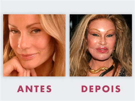 Cirurgias Plásticas que deram errado Dream Plastic