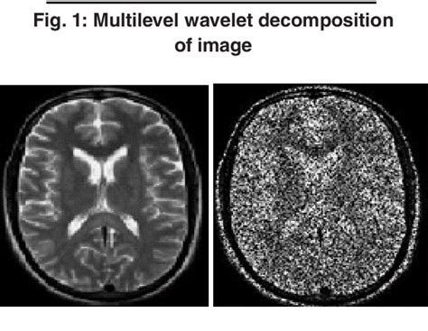 [pdf] analysis and comparison of wavelet transforms for denoising mri image semantic scholar