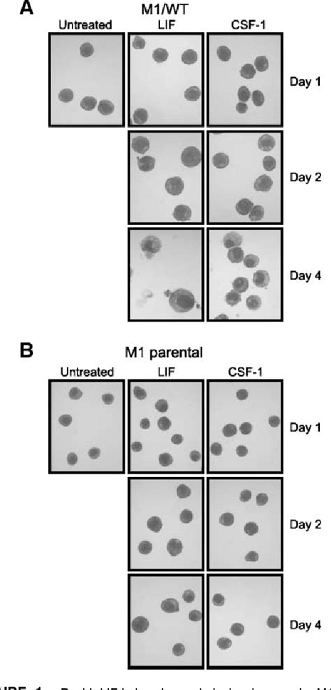 Figure 1 From The Critical Role Of The Colony Stimulating Factor 1