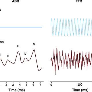 An Illustration Of Typical Stimuli And Recorded Waveforms Response