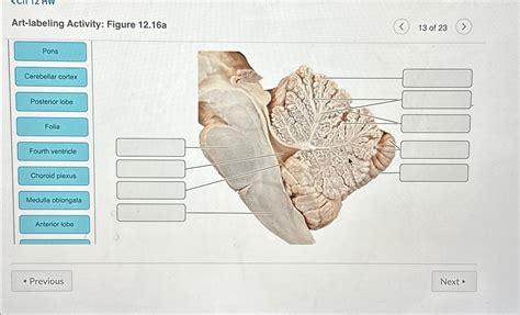 Solved Art Labeling Activity Figure 12 16a13 Of 23 Chegg