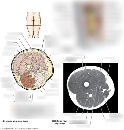 Cross Section Thigh Diagram Quizlet