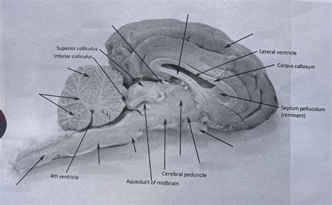 Sagittal Cut Of Sheep Brain Diagram Quizlet