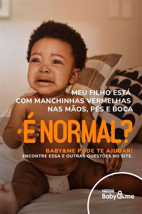A virose mão pé boca é uma doença contagiosa que atinge o sistema