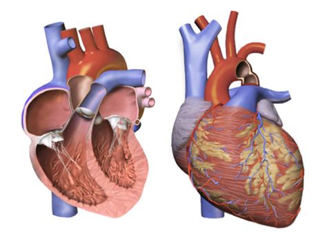 Congenital Heart Defect CHD Lesions Online Medical Library