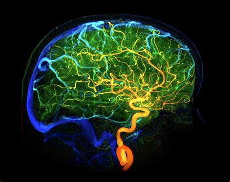 Brain Blood Vessels 3 By Zephyr Science Photo Library
