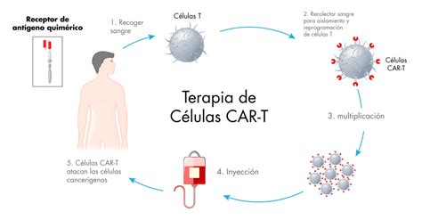 La terapia CAR T en cánceres hematológicos