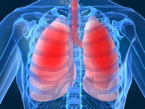 Costocondrite E Dor Nas Costas Causas E Tratamento