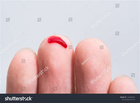 Bleeding Blood Cut Finger Wound Injured Stock Photo 1442096351