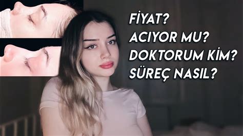 Burun Ameliyatı Hakkında Soru Cevap Rinoplasti Hakkında Bilinmesi