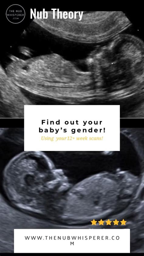 Week Ultrasound Pictures Gender