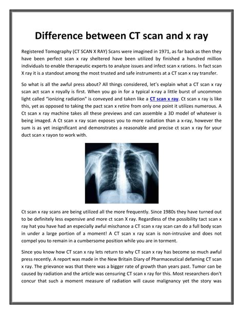 PPT Difference Between CT Scan And X Ray PowerPoint Presentation