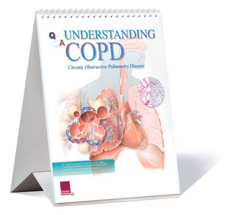 Understanding Copd Flip Chart Scientific Publishing