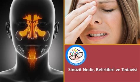 Sinüzit Nedir Belirtileri ve Tedavisi Nelerdir BiliminSesi Sağlık