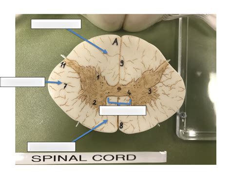 Spinal Cord Pt Diagram Quizlet