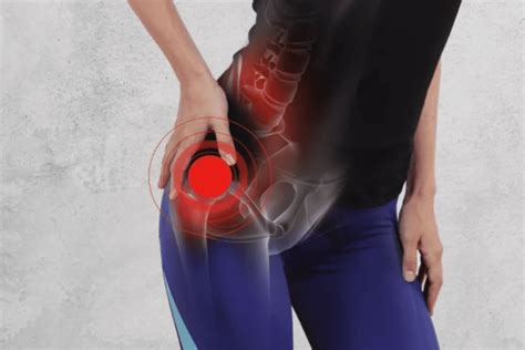 Principales Causas Del Dolor De Cadera Salud Youtube The Best Porn