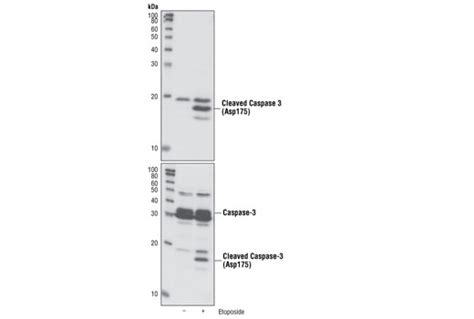 SignalSlide Cleaved Caspase 3 Asp175 IHC Controls Cell Signaling