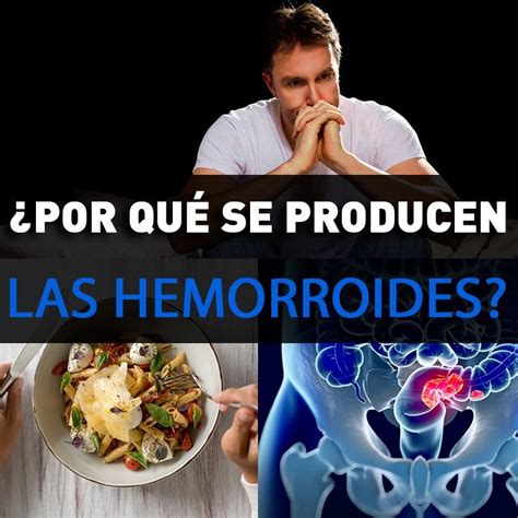 Por qué se producen las hemorroides causas y tratamiento La Guía de