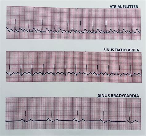EKG ECG Study Guide And Exam With Over 200 Questions Answers Etsy