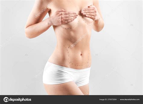 Mujer Desnuda Con Marcas En Su Cuerpo Sobre Fondo Claro Concepto De