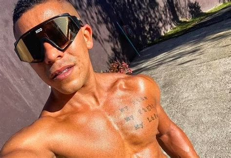 Reconocido Ciclista Pierde Una Pierna Tras Ser Atropellado Teletica