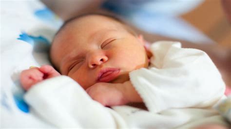 Ittero Del Neonato Fisiologico Emolitico Salute E Bellezza