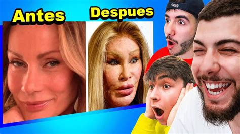 LAS PEORES OPERACIONES ESTETICAS DEL MUNDO HORRIBLES YouTube