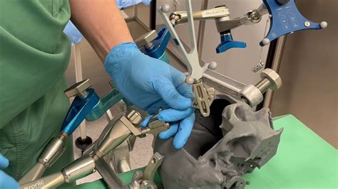 Modulare Trainingsmodelle In Der Neurochirurgie Kraniotomie