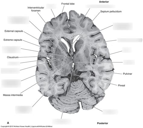 Neuro Labeling Diagram Quizlet